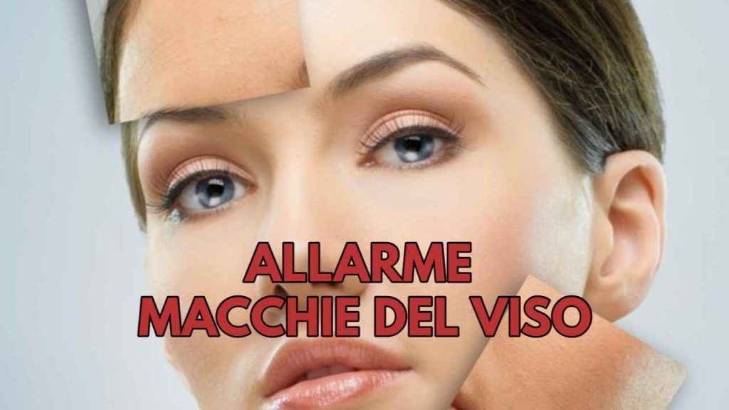 Macchie del viso | Allarme pelle: possono essere il sintomo di un problema