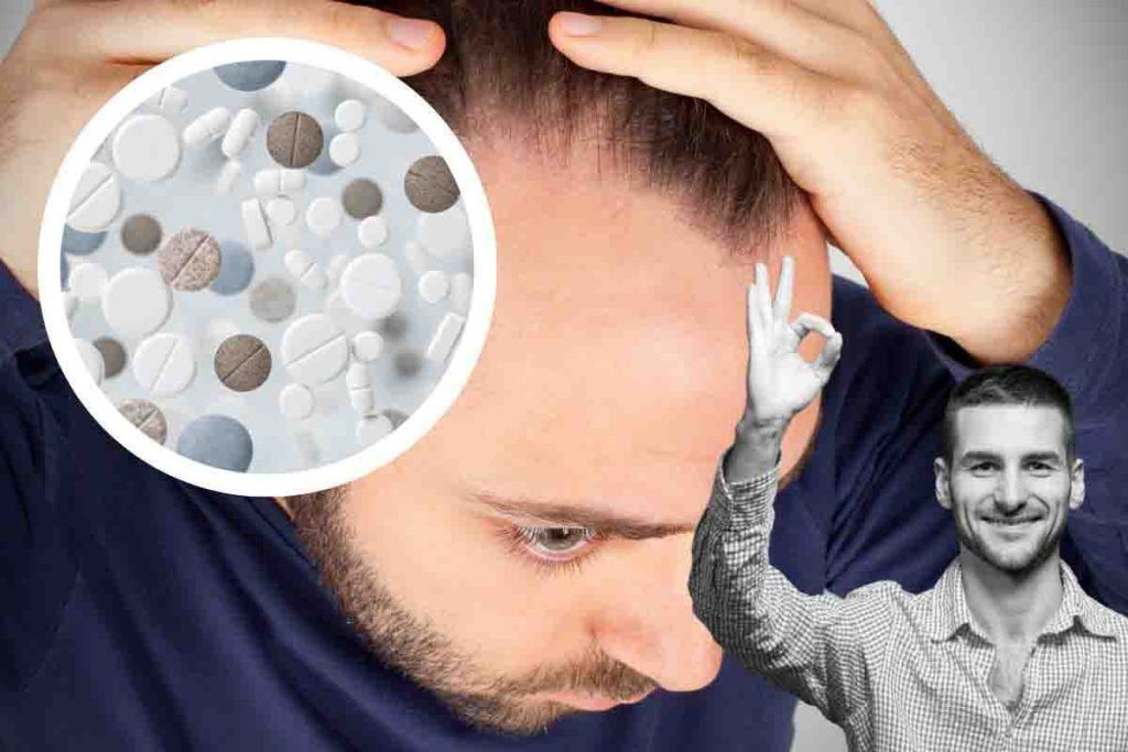 Calvizie: arrivano i nuovi farmaci, quali funzionano e quali no ...